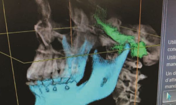 Introduction of the Concept of Biofunctional Dynamic Occlusion - High ...
